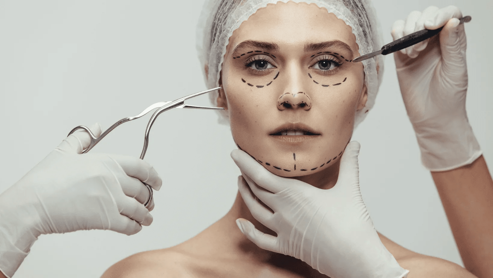 What is FFS in MTF? Your Guide to Facial Feminization Surgery