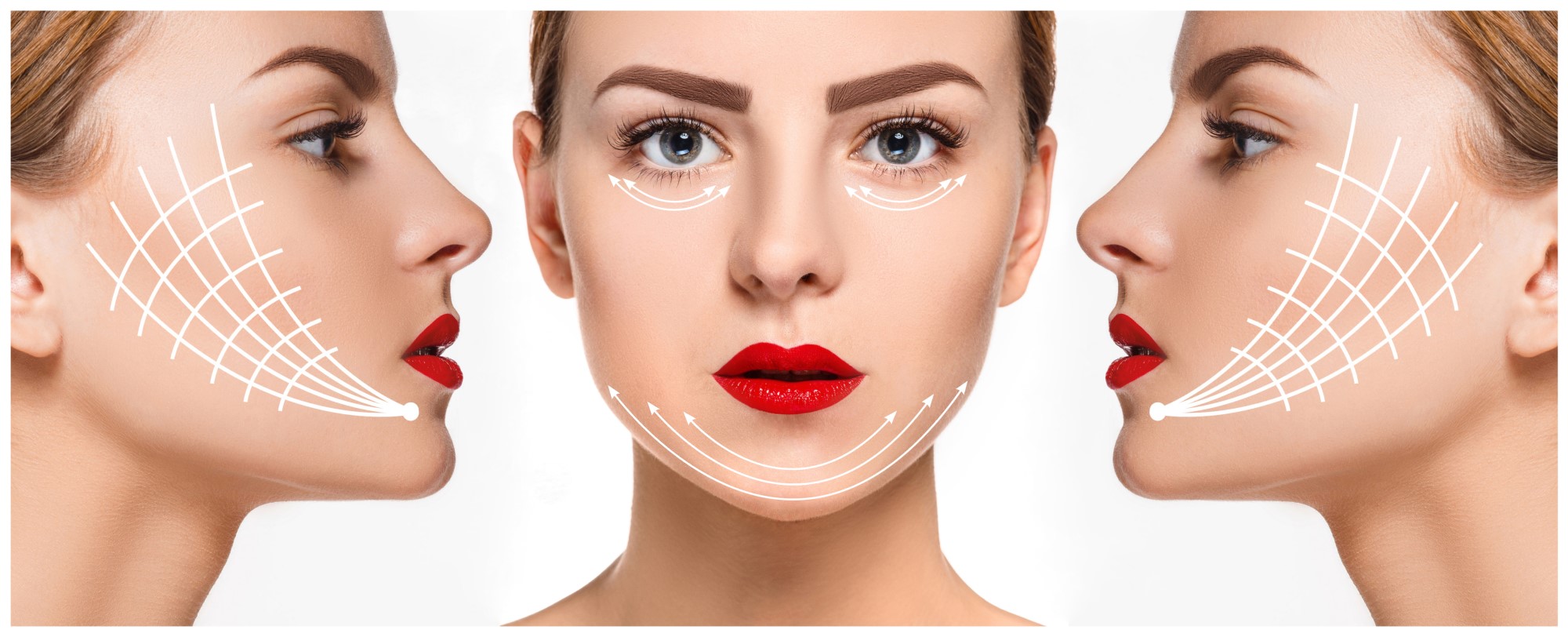 After Facial Feminization: How long does it take to see results ...