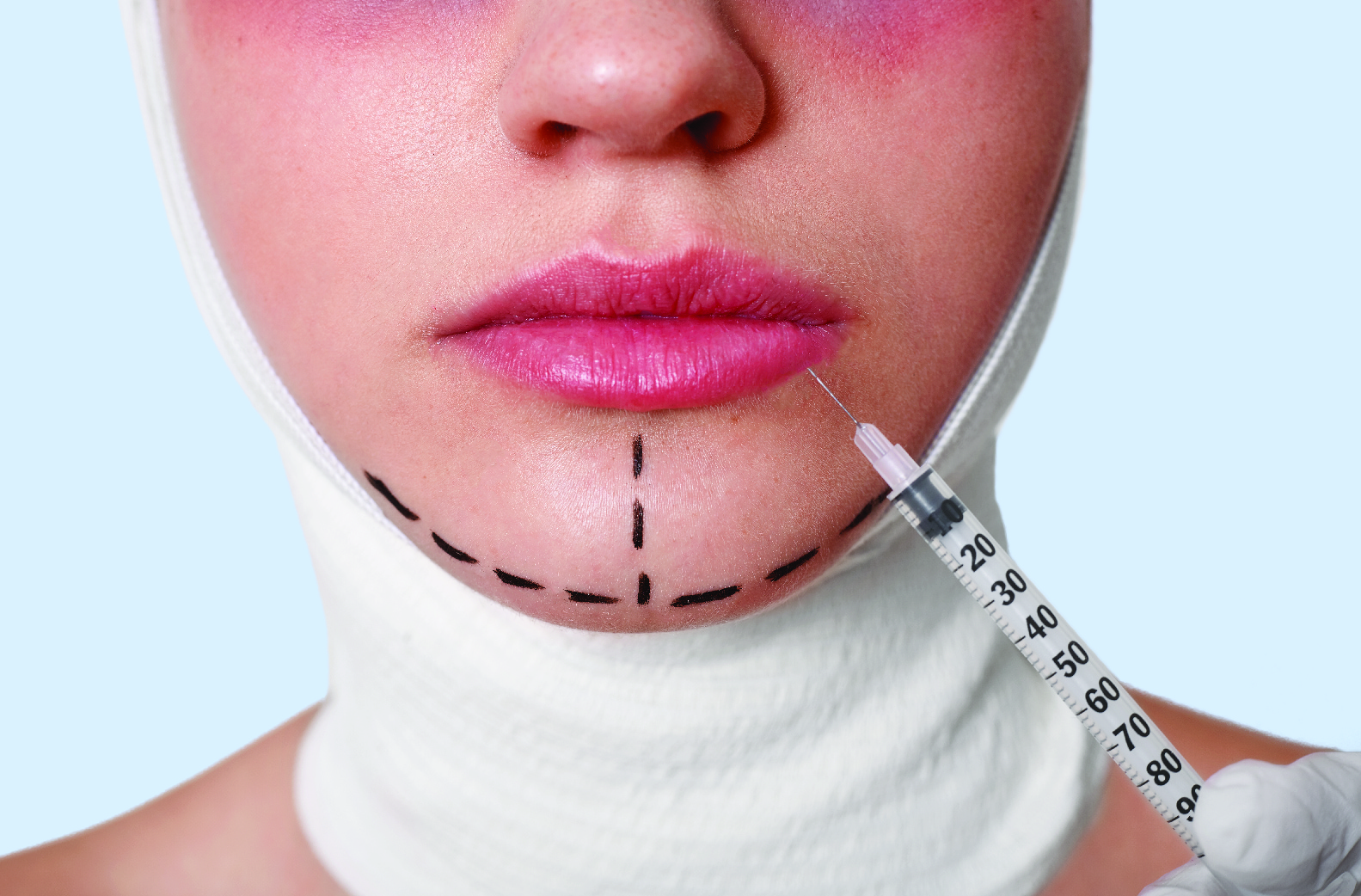 Why is Chin Reduction Surgery Important for the FFS Process ...