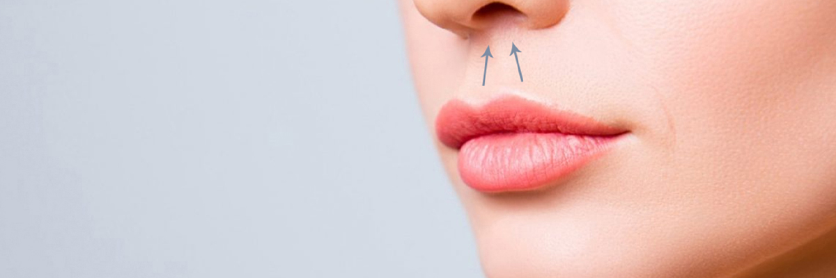 The Ins and Outs of Lip Lift Procedures: Is It Worth It? - Feminization ...